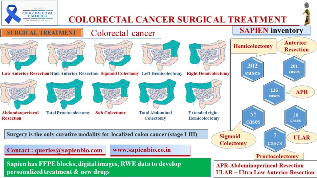 Colorectal cancer Awareness – Choice of surgery – Sapien Biosciences